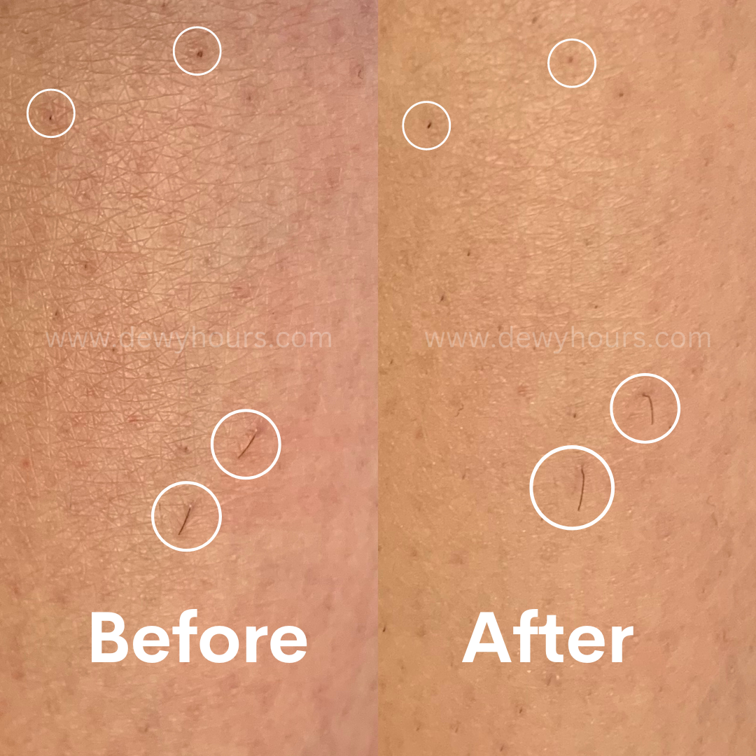 The Full Deep Exfoliation Bundle – Dewy Hours